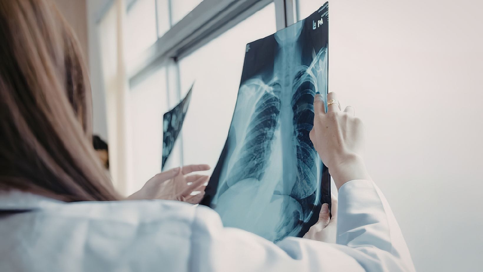 Consultații pulmonare gratuite în raionul Hîncești. Unde va ajunge ...